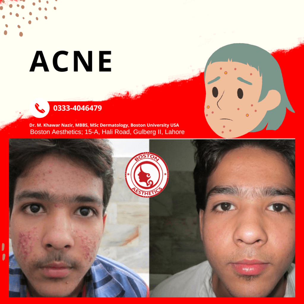 Gallery - Boston Aesthetics