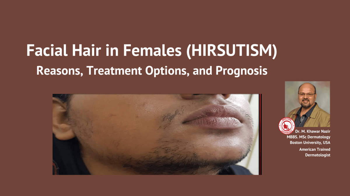 Facial Hair in Females: Reasons, Treatment Options, and Prognosis ...