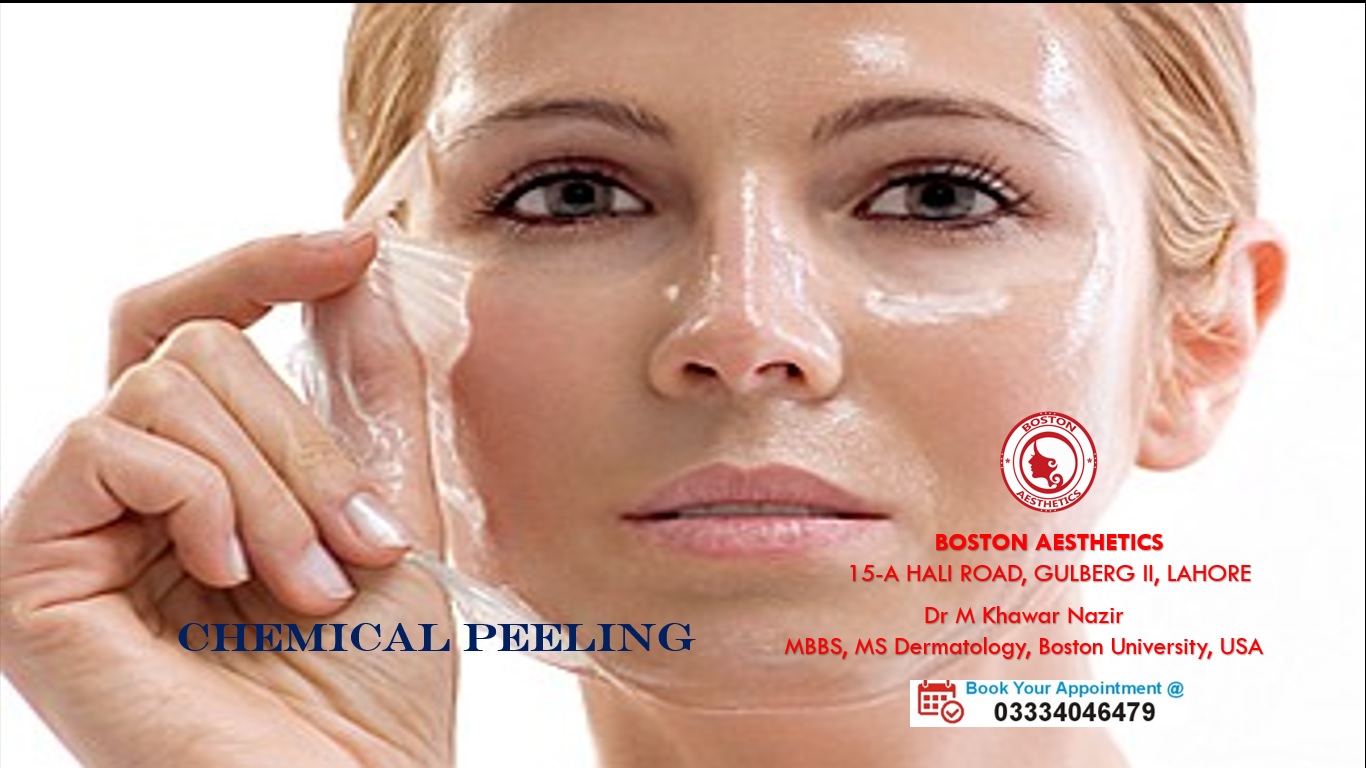 Chemical Peeling: Unveil Your Best Skin Yet - Boston Aesthetics