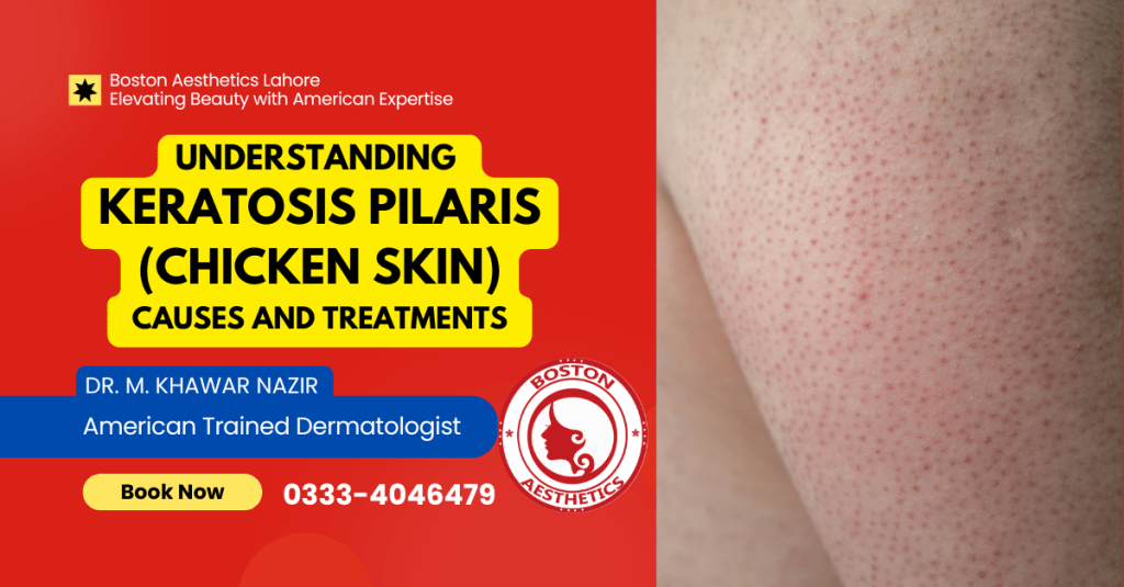 Beat Keratosis Pilaris (Chicken Skin) Now! – Boston Aesthetics