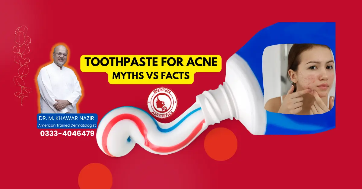 Toothpaste for Acne: Myths vs Facts in Lahore - Boston Aesthetics