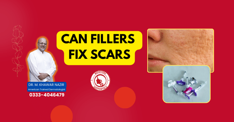 Scar SOS: Can Fillers Fix Scars in Lahore? - Boston Aesthetics