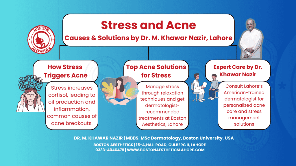 Stress, Acne & Solutions from Lahore’s Dermatology Expert - Boston ...