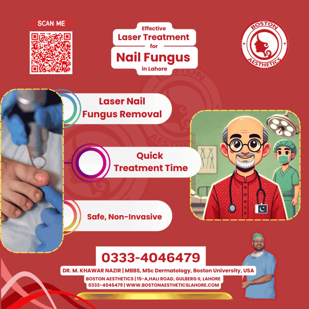 Effective Laser Treatment for Nail Fungus in Lahore - Boston Aesthetics