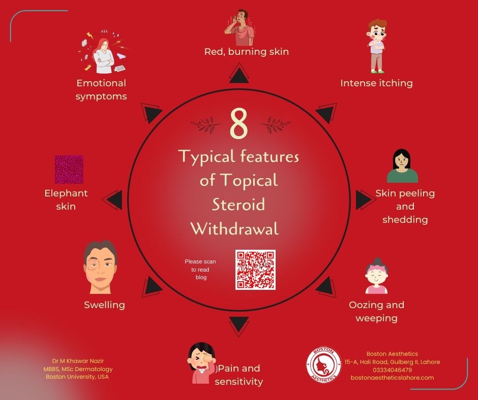 Topical steroid withdrawal | Burning Skin, Healing Hope